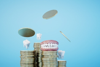 All 4 Dental Implants Cost Sydney Laser Care