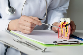 How to Remove Tooth Decay Yourself and When to Seek Help